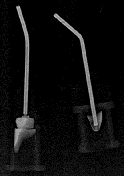 MST Visco-Tips™ – Vista Apex